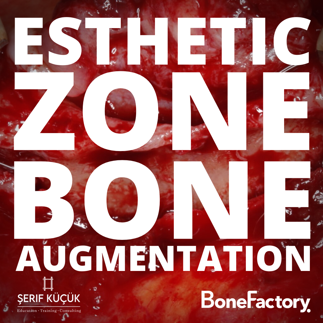 ESTHETIC ZONE BONE AUGMENTATION – BoneFactory Academy
